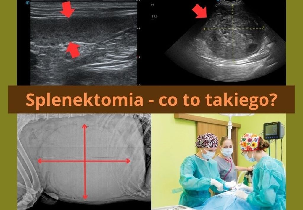 Splenektomia - brzmi poważnie, ale co to takiego? | Przychodnia ...