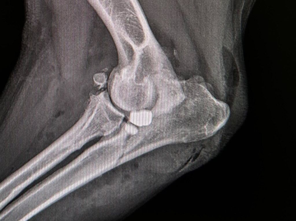 Canine elbow dysplasia. CUE surgery Vetriver Clinic | VETRIVER ...