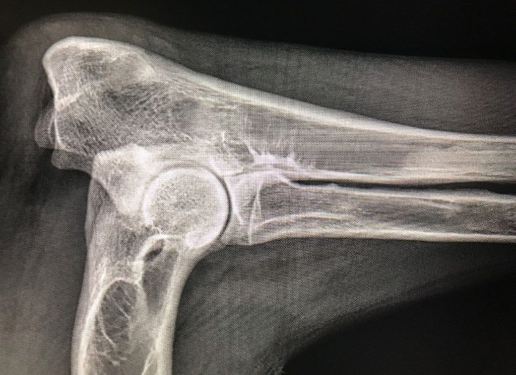 Młodzieńcze zapalenie kości - Enostoza. Leczenie Klinika Vetriver ...